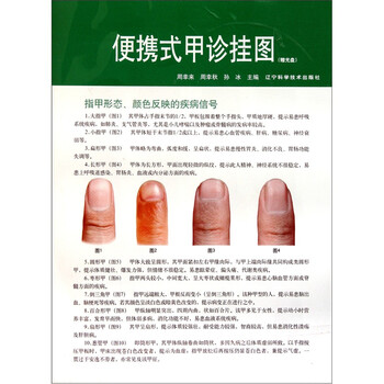 便携式甲诊挂图（附光盘1张）