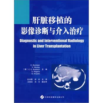正版 肝脏移植的影像诊断与介入治疗9787543323100