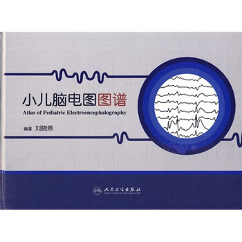 [正版图书]小儿脑电图图谱