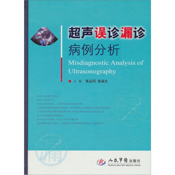 正版 超声误诊漏诊病例分析9787509131121