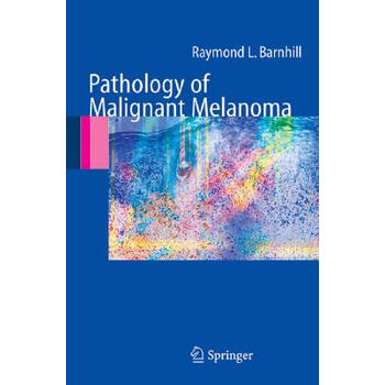 【】Pathology of Malignant Melanoma