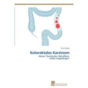 【】Kolorektales Karzinom