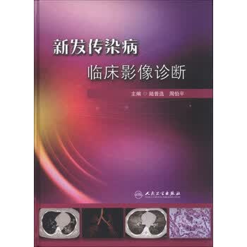 新发传染病临床影像诊断
