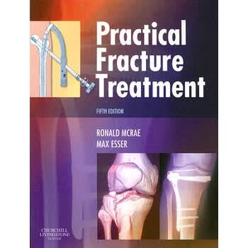 【】Practical Fracture Treatment