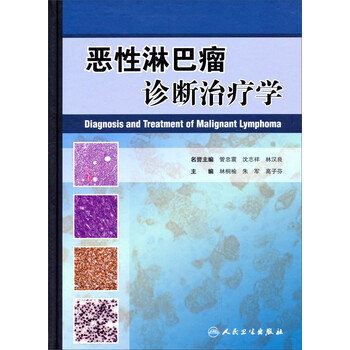 恶性淋巴瘤诊断治疗学