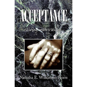 【】Acceptance