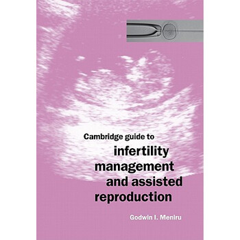 【】Cambridge Guide to Infertility