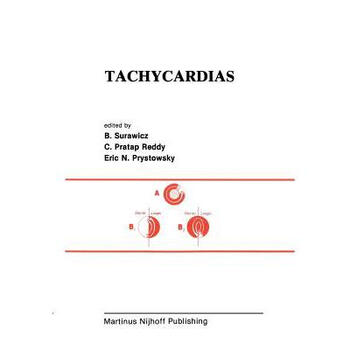 Tachycardias