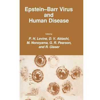 Epstein-Barr Virus and Human Disease