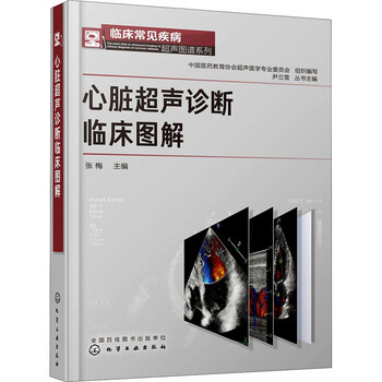 心脏超声诊断临床图解 图书