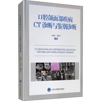 口腔颌面部疾病CT诊断与鉴别诊断