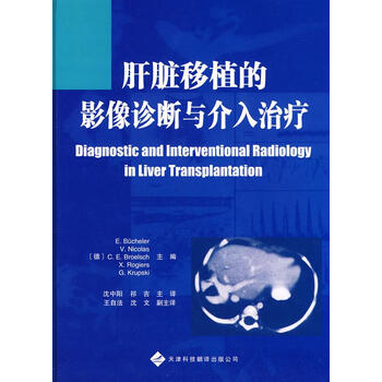 肝脏移植的影像诊断与介入 医学 （德）布彻勒 天津科技翻译出版公司 9787543323100