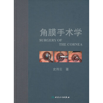角膜手术学 史伟云 人民卫生出版社 9787117163019