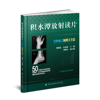积水潭放射读片——骨肿瘤之腕踝关节篇