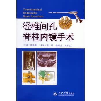 经椎间孔脊柱内镜手术