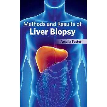 Methods and Results of Liver Biopsy
