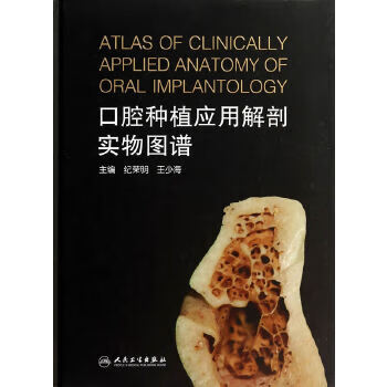 口腔种植应用解剖实物图谱