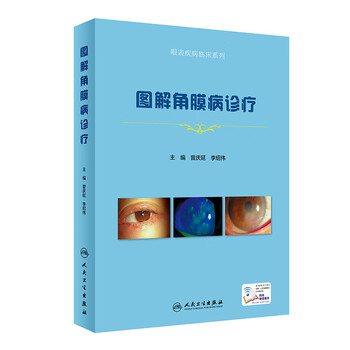 图解角膜病诊疗