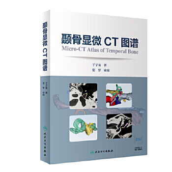 【耳科学】【影像图谱】颞骨显微CT图谱 于子龙著