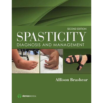 高被引Spasticity: Diagnosis and Management