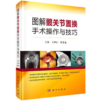 图解髋关节置换手术操作与技巧(精)