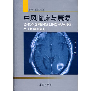 中风临床与康复 张子明,李惠兰 华夏出版社