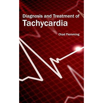 Diagnosis and Treatment of Tachycardia