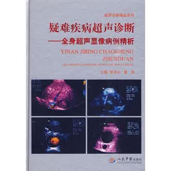 疑难疾病超声诊断-全身超声显病例精析富京山军医出版社9787509132944 医学书籍