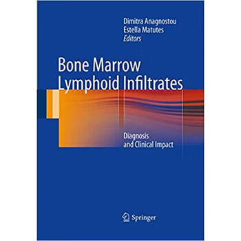 高被引Bone Marrow Lymphoid Infiltrates: Diagnosis