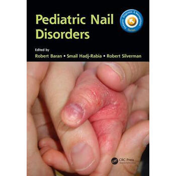 Pediatric Nail Disorders