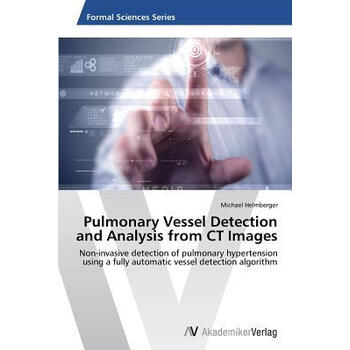 Pulmonary Vessel Detection and Analysis from CT