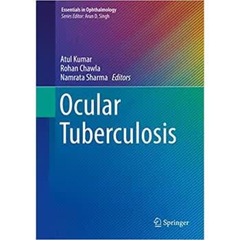 Ocular Tuberculosis