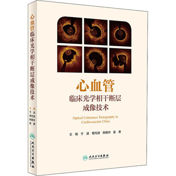 心血管临床光学相干断层成像技术