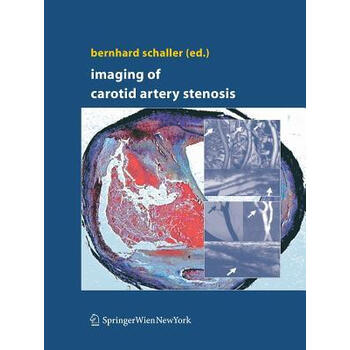 Imaging of Carotid Artery Stenosis (2007)