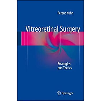Vitreoretinal Surgery: Strategies and Tactics   