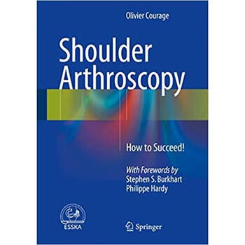 Shoulder Arthroscopy: How to Succeed!