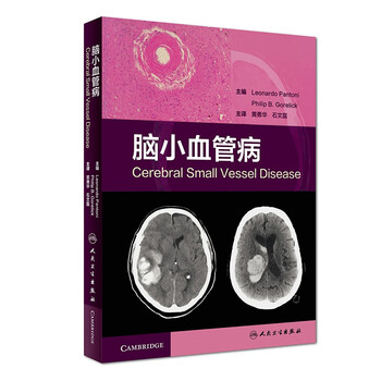脑小血管病