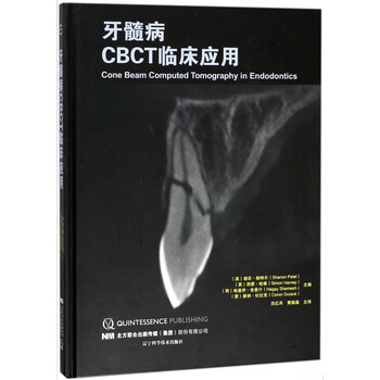 牙髓病CBCT临床应用(精)