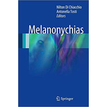 Melanonychias