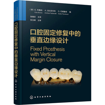 口腔固定修复中的垂直边缘设计