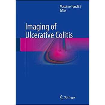 Imaging of Ulcerative Colitis