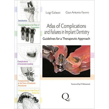 Atlas of Complications and Failures in Implant D