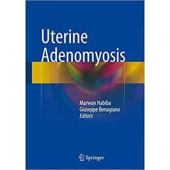Uterine Adenomyosis
