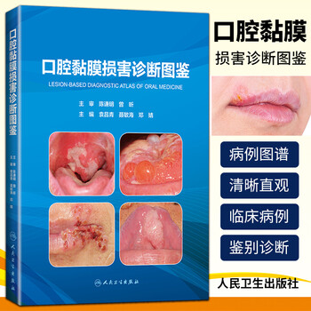 口腔黏膜损害诊断图鉴
