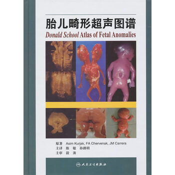 胎儿畸形超声图谱【正版图书】