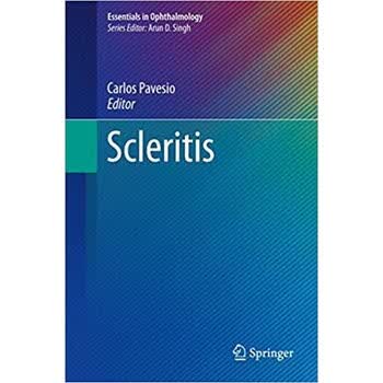 Scleritis