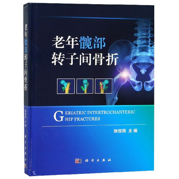 老年髋部转子间骨折(精)