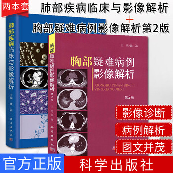   肺部疾病临床与影像解析+胸部疑难病例影像解析第2版  张嵩 编 科学出版社 医学影像 胸