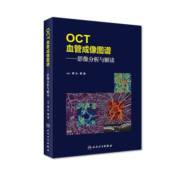OCT血管成像图谱——影像分析与解读