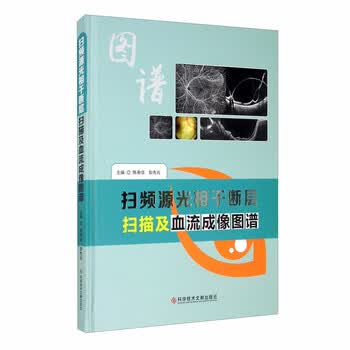 扫频源光相干断层扫描及血流成像图谱